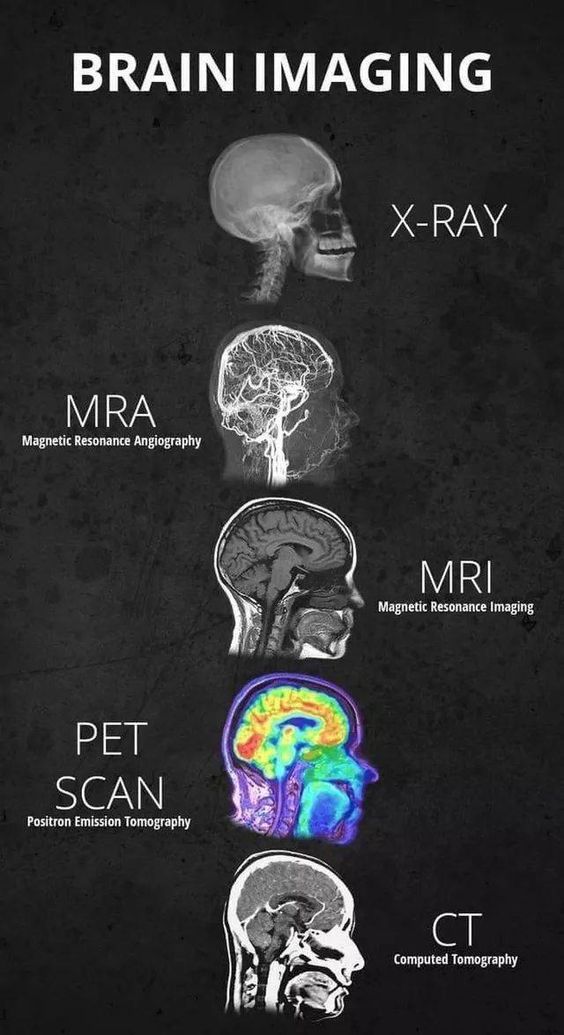MRI vs. MRA vs. PET Scan vs. X-Ray: What’s the Difference?