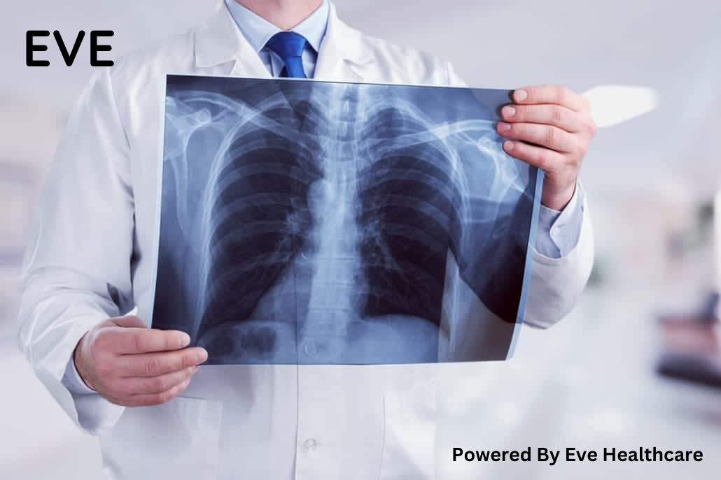 X Ray Cervical Spine Flexion Extension